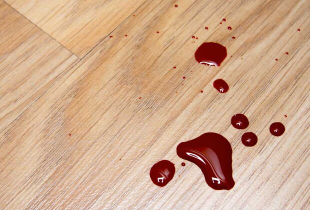 How to get rid of blood stains yourself and with the help of blood ...